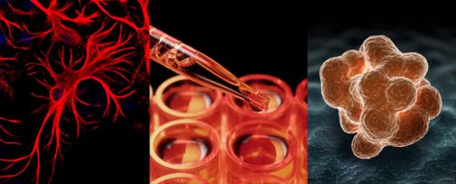 In Vitro Human Primary Cell-Based Assay I Kosheeka