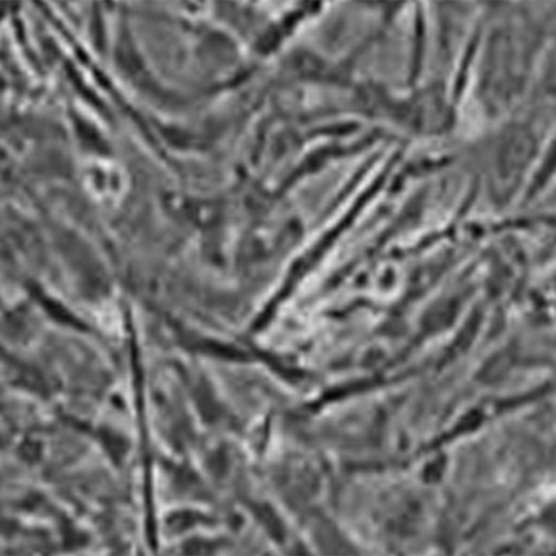 Swine Skeletal Muscle Fibroblasts - Kosheeka